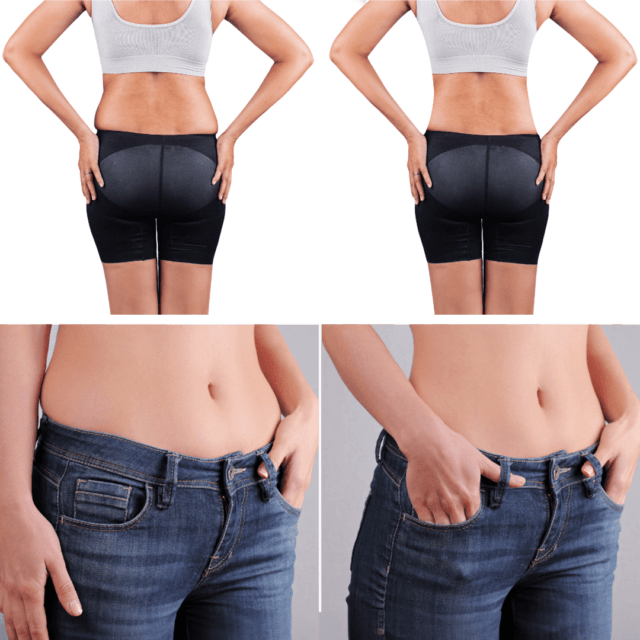 Fat Dissolve Injections in Stuart & Delray Beach, FL | Non-Surgical Fat ...